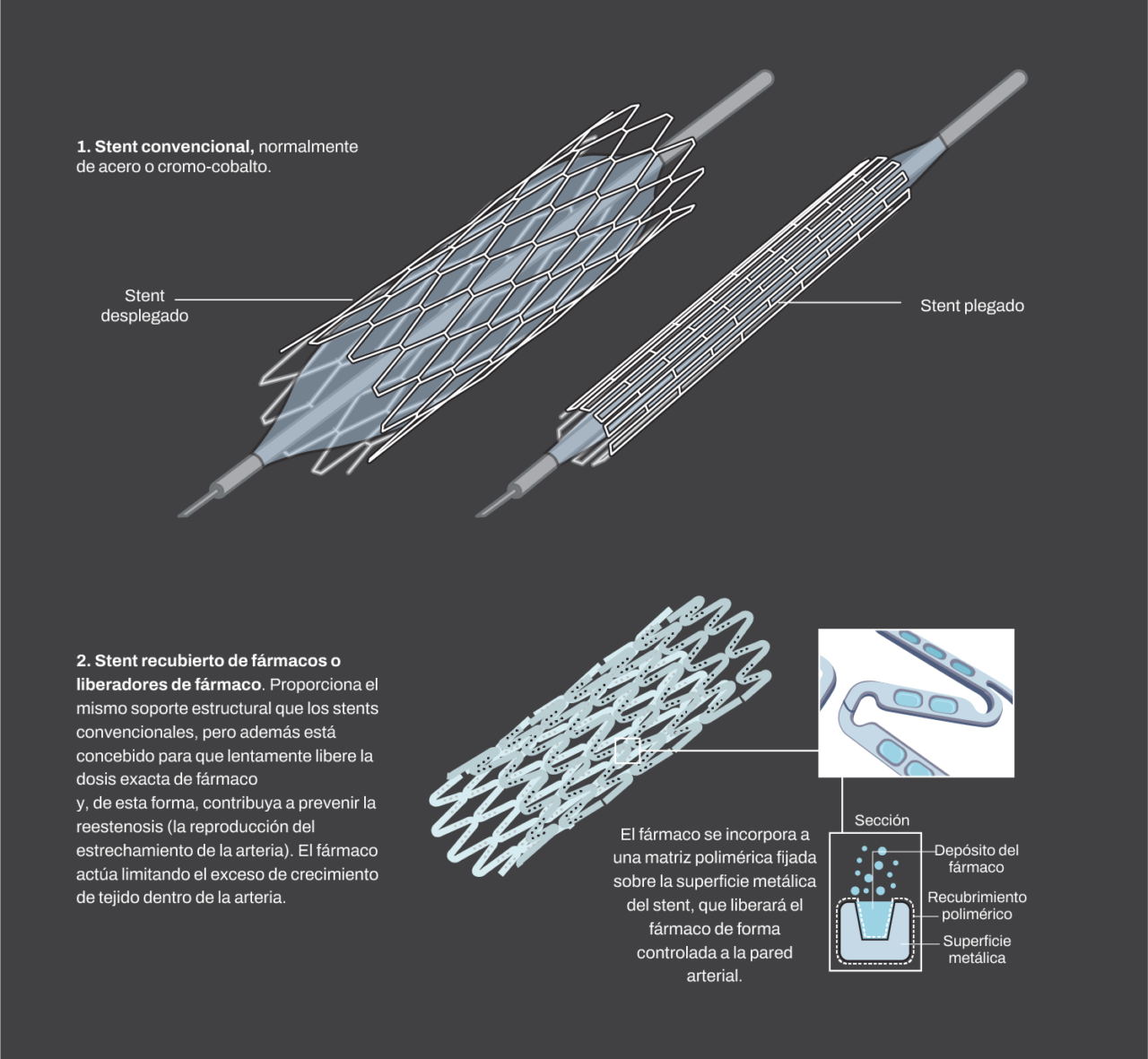 Implante de Stents - Dr. Ricardo García de la Peña